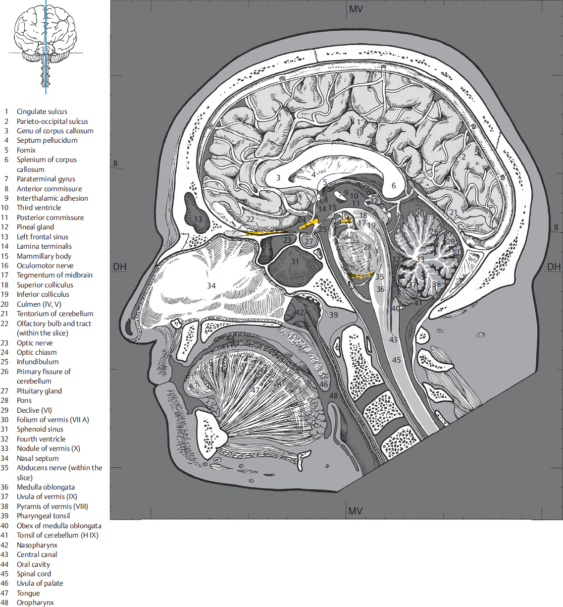 4 Sagittal Sections Radiology Key
