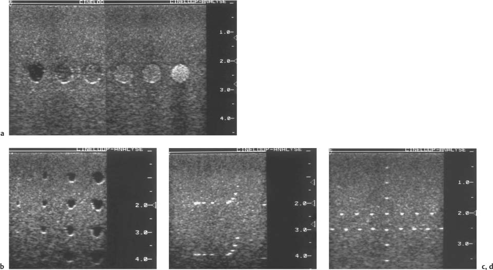 Basic Principles | Radiology Key