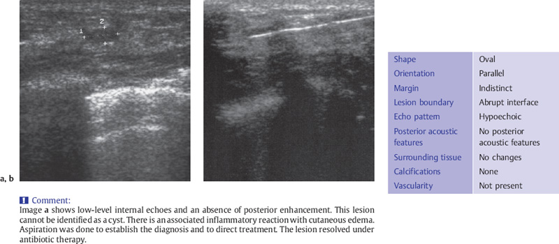 Abscesses | Radiology Key
