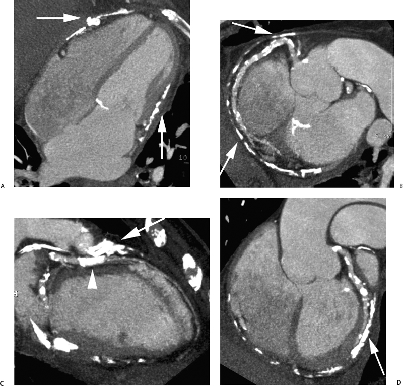 Cardiac Morphology and Function | Radiology Key