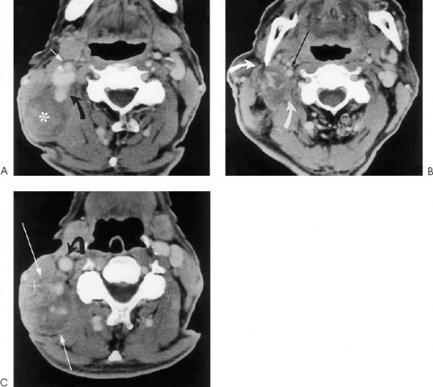 Normal Variants That May Mimic Disease | Radiology Key