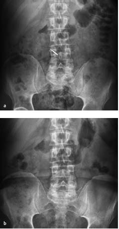 Pathology of the Neck | Radiology Key