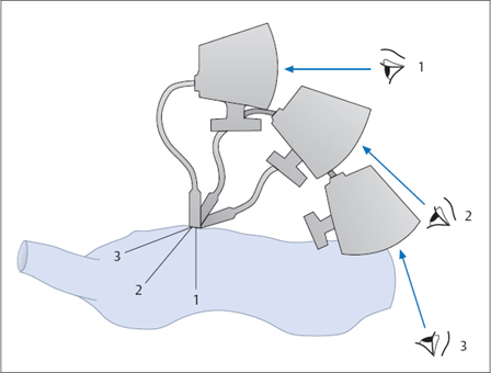 General | Radiology Key