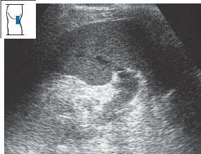 Spleen | Radiology Key