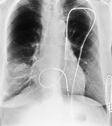 The Elements of Cardiac Imaging | Radiology Key