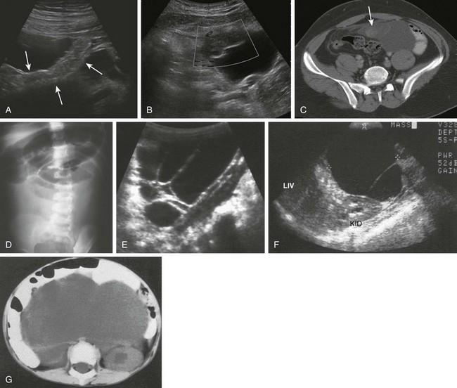 Congenital and Neonatal Disorders | Radiology Key