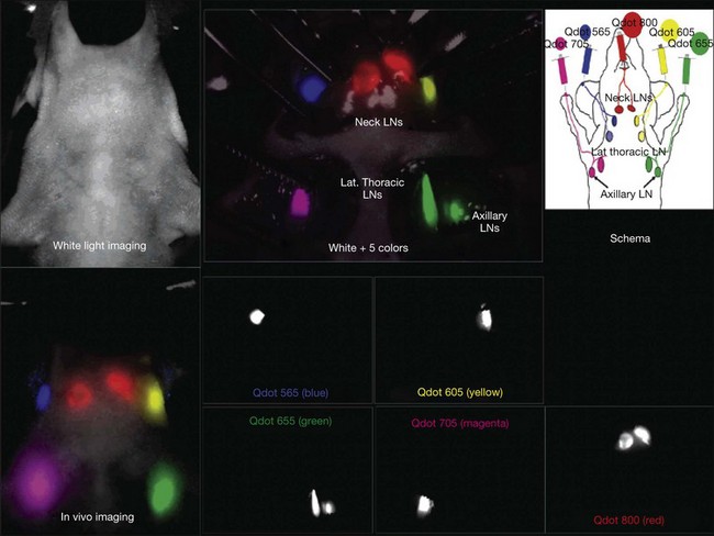 Advanced Imaging Technologies | Radiology Key