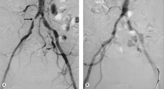 Anatomy of the lower-limb venous system and assessment of venous ...