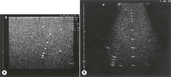 Optimizing the diagnostic information | Radiology Key