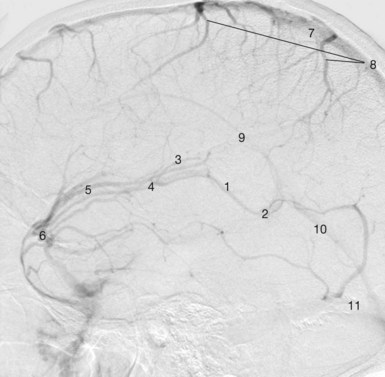 The central nervous system | Radiology Key