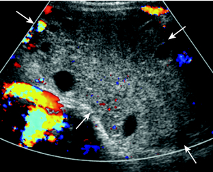 Genitourinary | Radiology Key