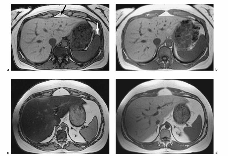 The Liver Radiology Key The Liver Radiology Key