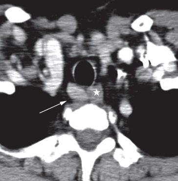 Orbits, Head and Neck | Radiology Key