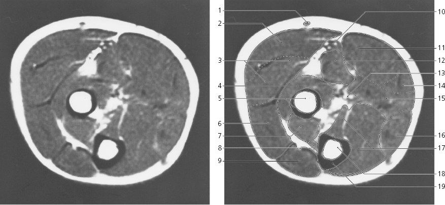 Spine | Radiology Key