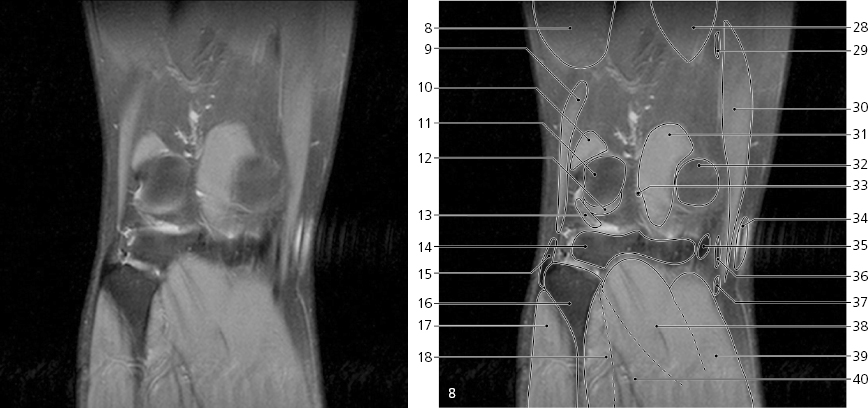 Knee | Radiology Key