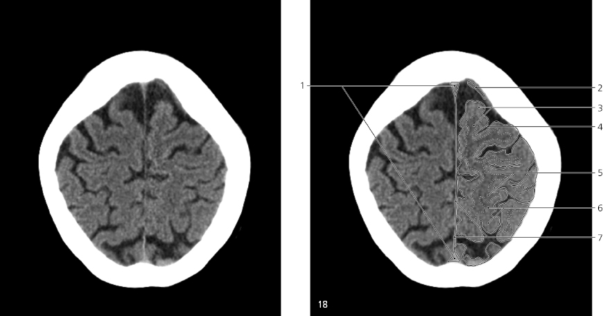 CT Series | Radiology Key