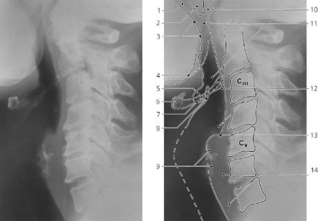 Esophagus | Radiology Key
