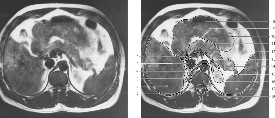 Stomach | Radiology Key