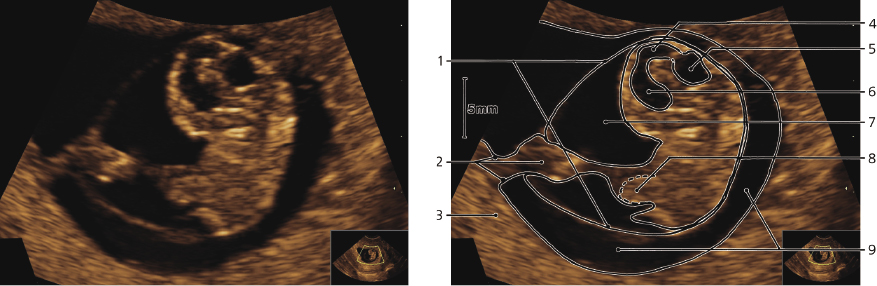 Genital Organs/Embryo | Radiology Key