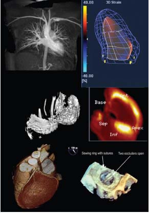 Imaging planes | Radiology Key