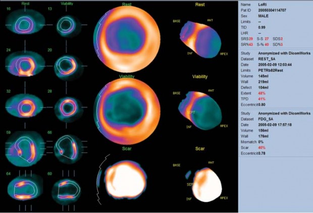 40 Misregistration on PET | Radiology Key