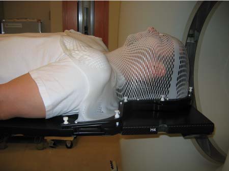 84 Head and Neck Cancer 3 | Radiology Key