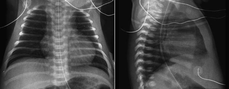 Normal Cardiovascular Anatomy for Imaging | Radiology Key