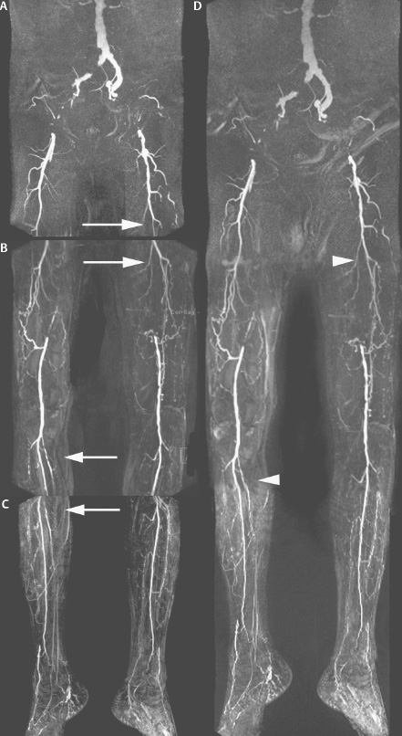 Image Composing | Radiology Key