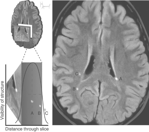 Slice Profile | Radiology Key