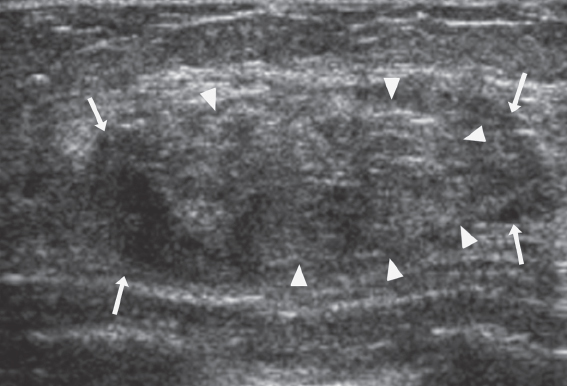2 | Radiology Key
