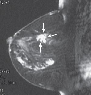 48 | Radiology Key