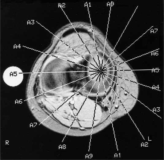 Technology of Magnetic Resonance Imaging | Radiology Key