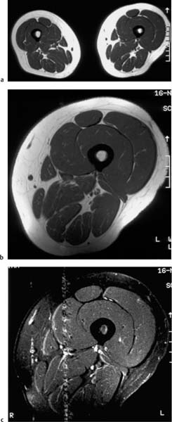 Musculature | Radiology Key