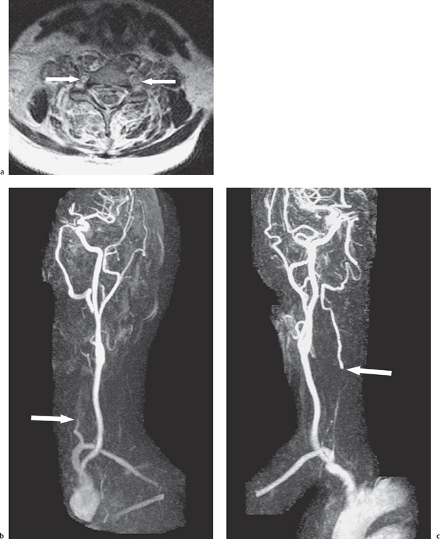 Neurovascular Injuries _ Neurovascular Injury Meaning – UNEB
