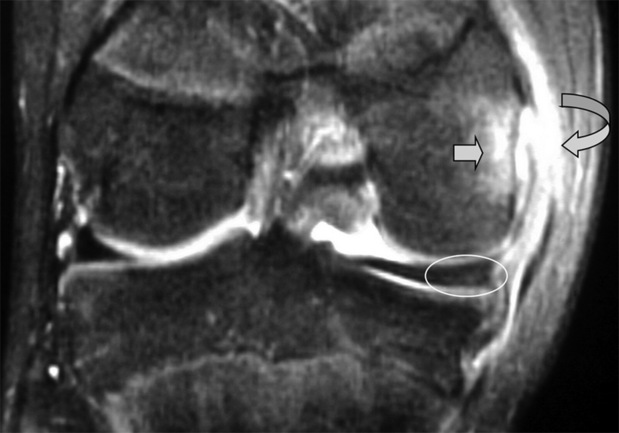The knee | Radiology Key