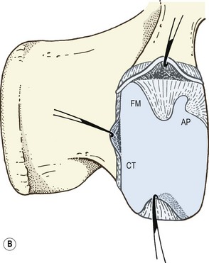 The zygapophysial joints – detailed structure | Radiology Key