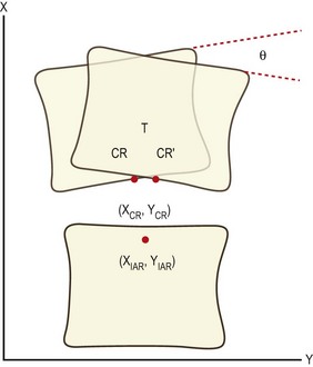 The interbody joint and the intervertebral discs | Radiology Key