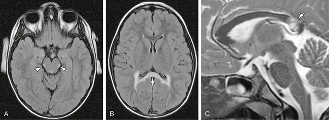 Cranial Nerves | Radiology Key