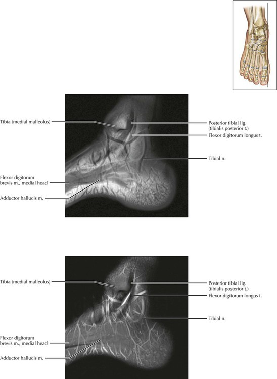 Ankle and Foot | Radiology Key