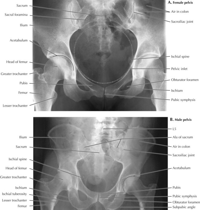 Pelvic X Ray Anatomy