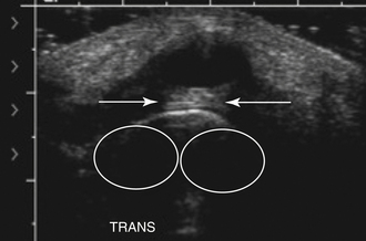 Basic Approach to Ultrasound of Other Structures in the Extremities ...