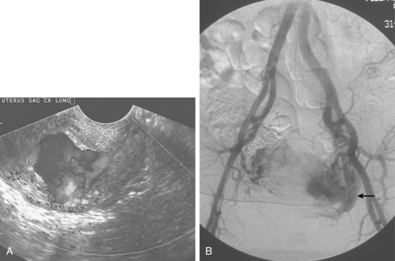 Endocrine, exocrine, and reproductive systems | Radiology Key