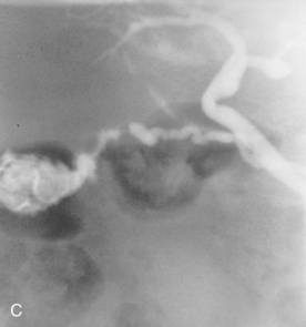 Biliary system | Radiology Key
