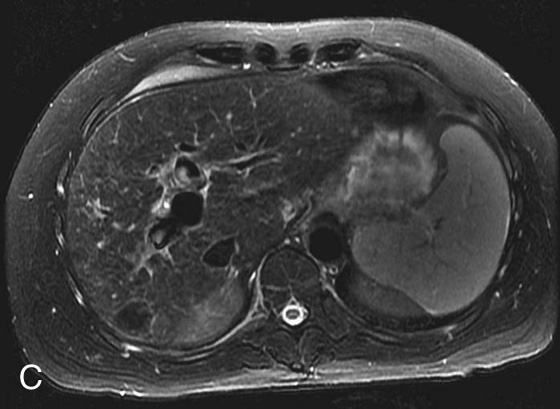 Contrast | Radiology Key