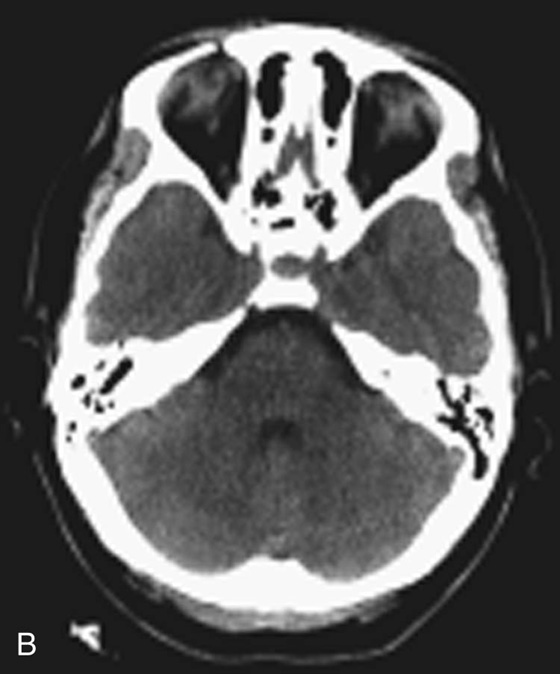 Contrast | Radiology Key