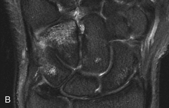Artifact | Radiology Key