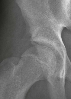 Pelvis | Radiology Key