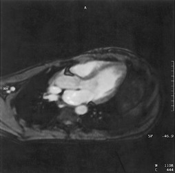 Echo-Planar Imaging | Radiology Key
