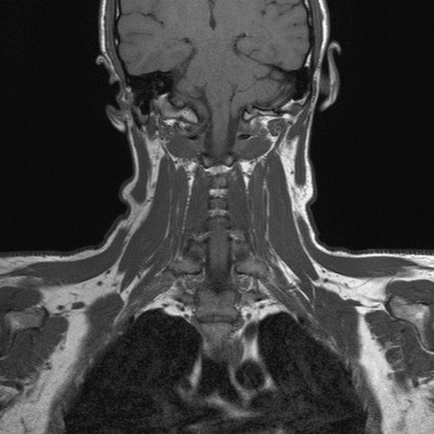 Contrast agents | Radiology Key