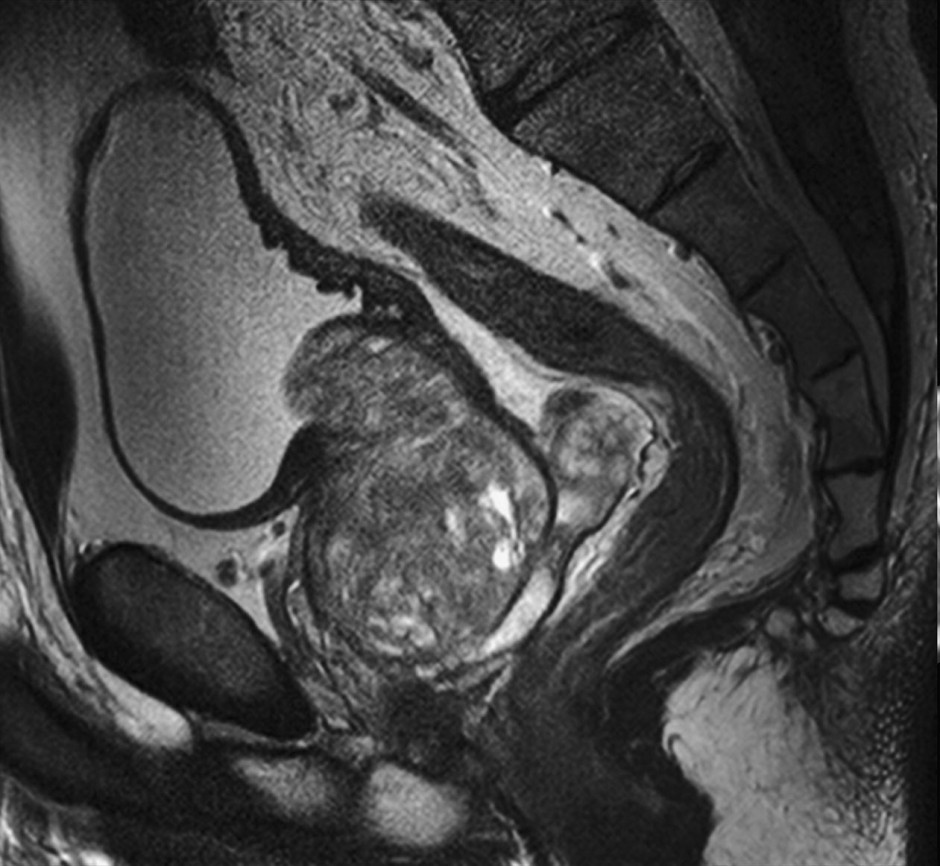 Contrast agents | Radiology Key